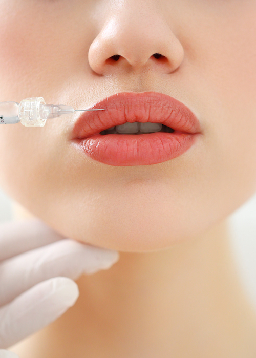 Revanesse Versa & Radiesse: Injectable Fillers | L.A Vinas